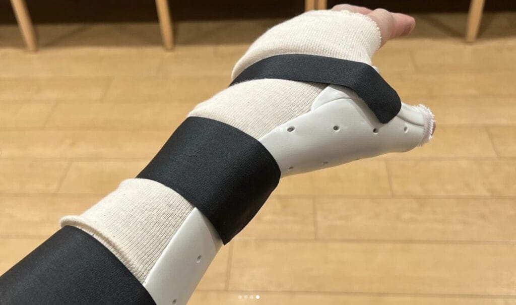 Peloton Instructor Alex Karwoski Recovering from Injury (Broken Bones ... Peloton Instructor Alex Karwoski Recovering from Injury (Broken Bones ...